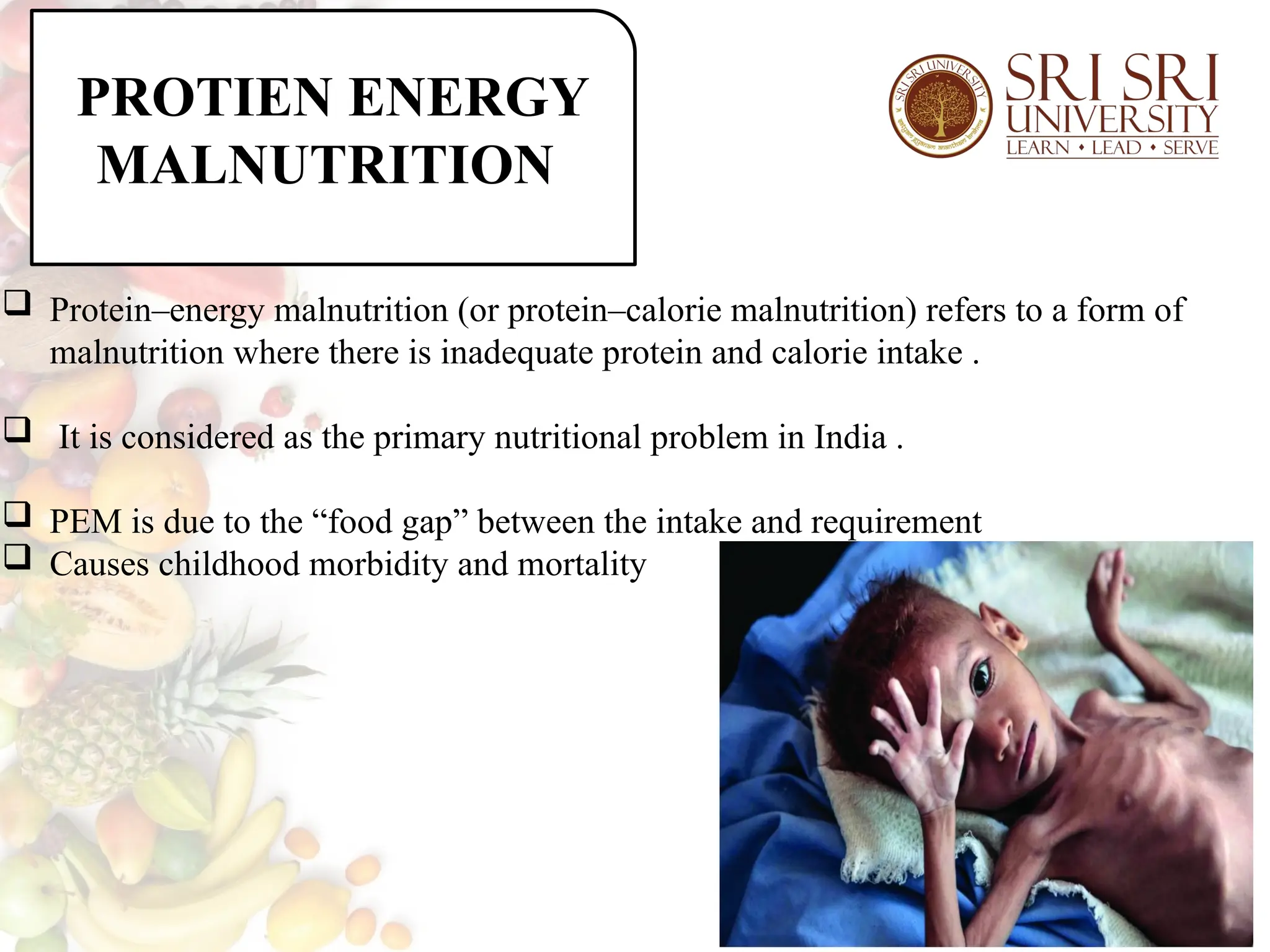 "Comprehensive Overview of Nutritional Disorders " | PPT