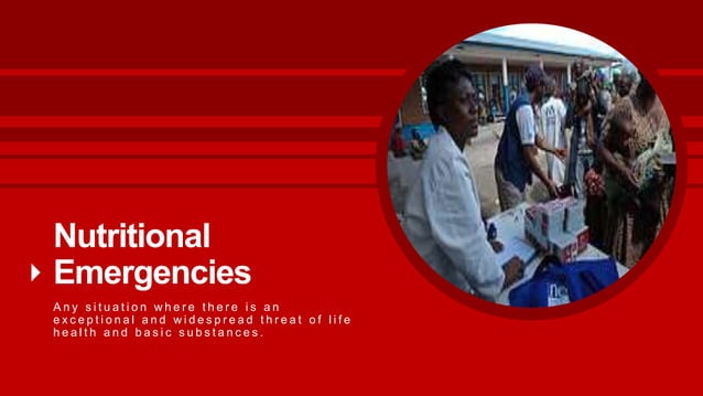 Nutritional Emergencies | PPTX | Nutrition | Healthy Living