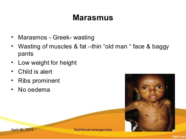 Nutritional emergencies 2015
