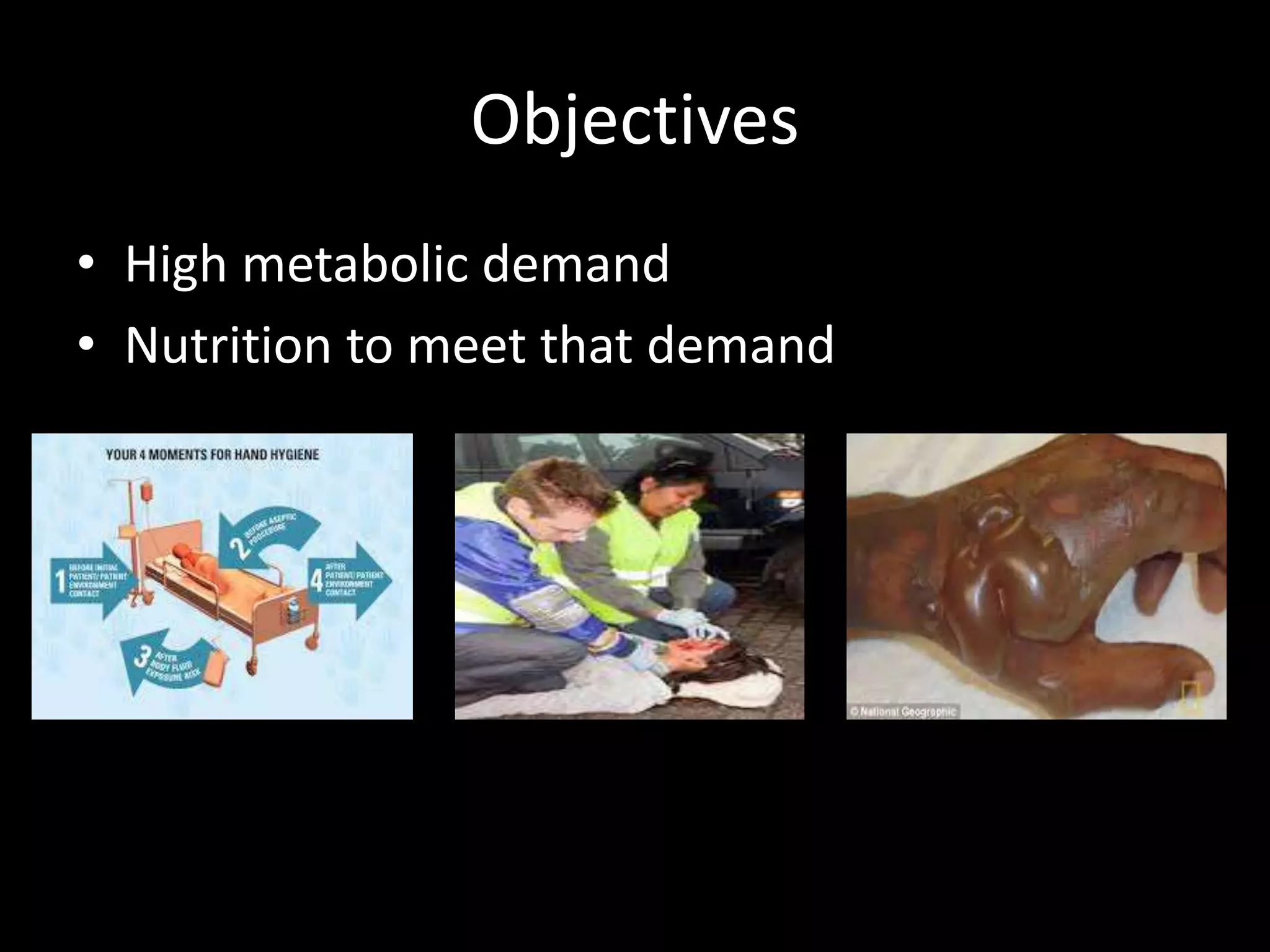 Nutritional issues in sepsis, trauma & burn patients | PPTX