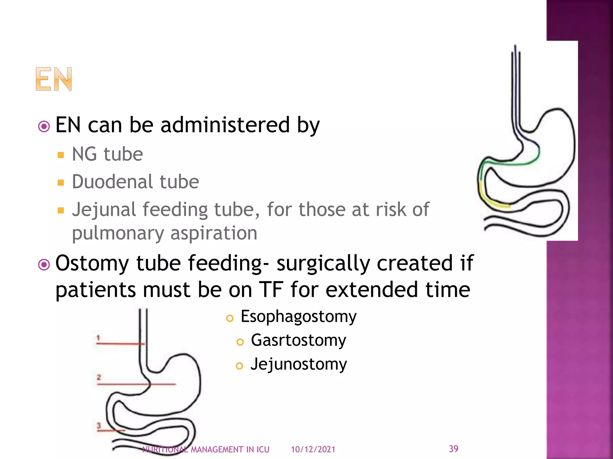 Nutritional management in the ICU | PPTX