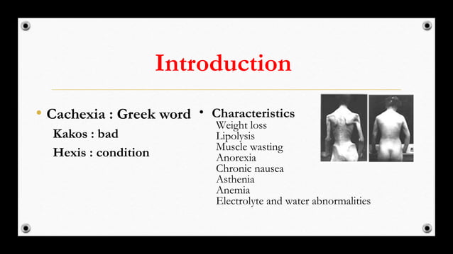 Nutritional managment of cachexia | PPT | Nutrition | Healthy Living