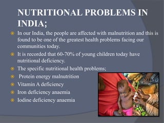 Nutritional problems | PPTX