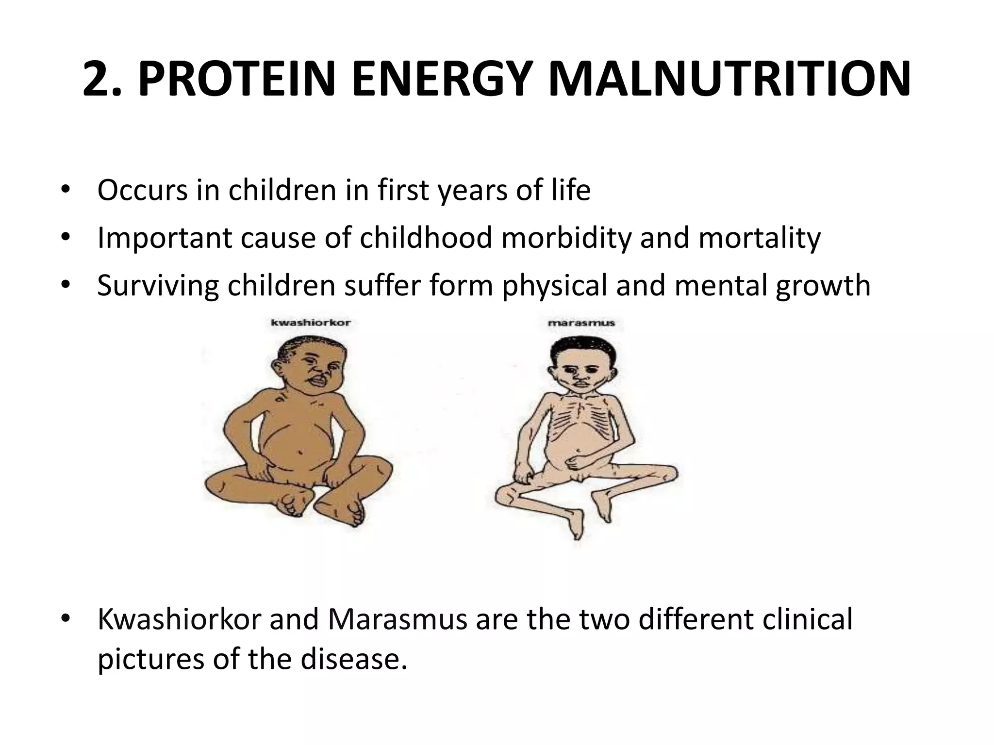 Nutritional problems in public health | PPTX