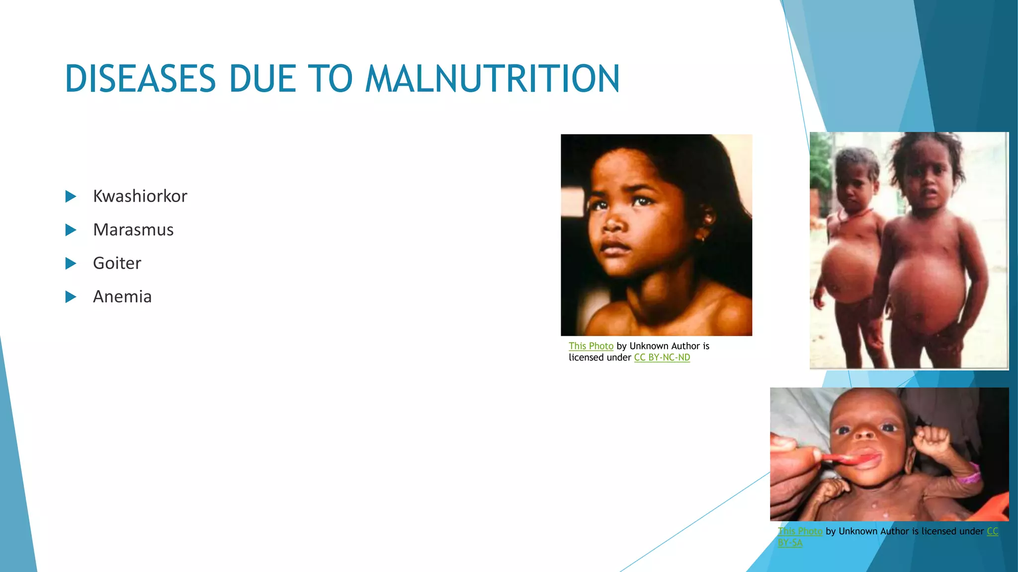 NUTRITIONAL STATUS AS AN INDICATOR OF HEALTH.pptx