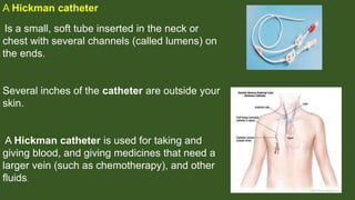 Nutritional support in surgical patients | PPTX