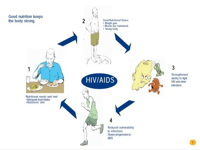 Nutrition and HIV/AIDS