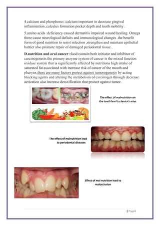 Nutrition and oral health | PDF