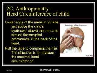 Nutrition assessment in children- dr harivansh chopra | PPT
