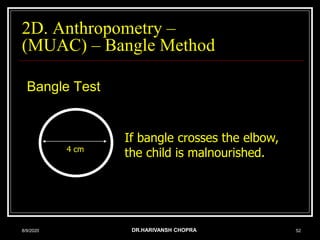Nutrition assessment in children- dr harivansh chopra | PPT