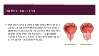 Nutrition case study- BPH | PPT
