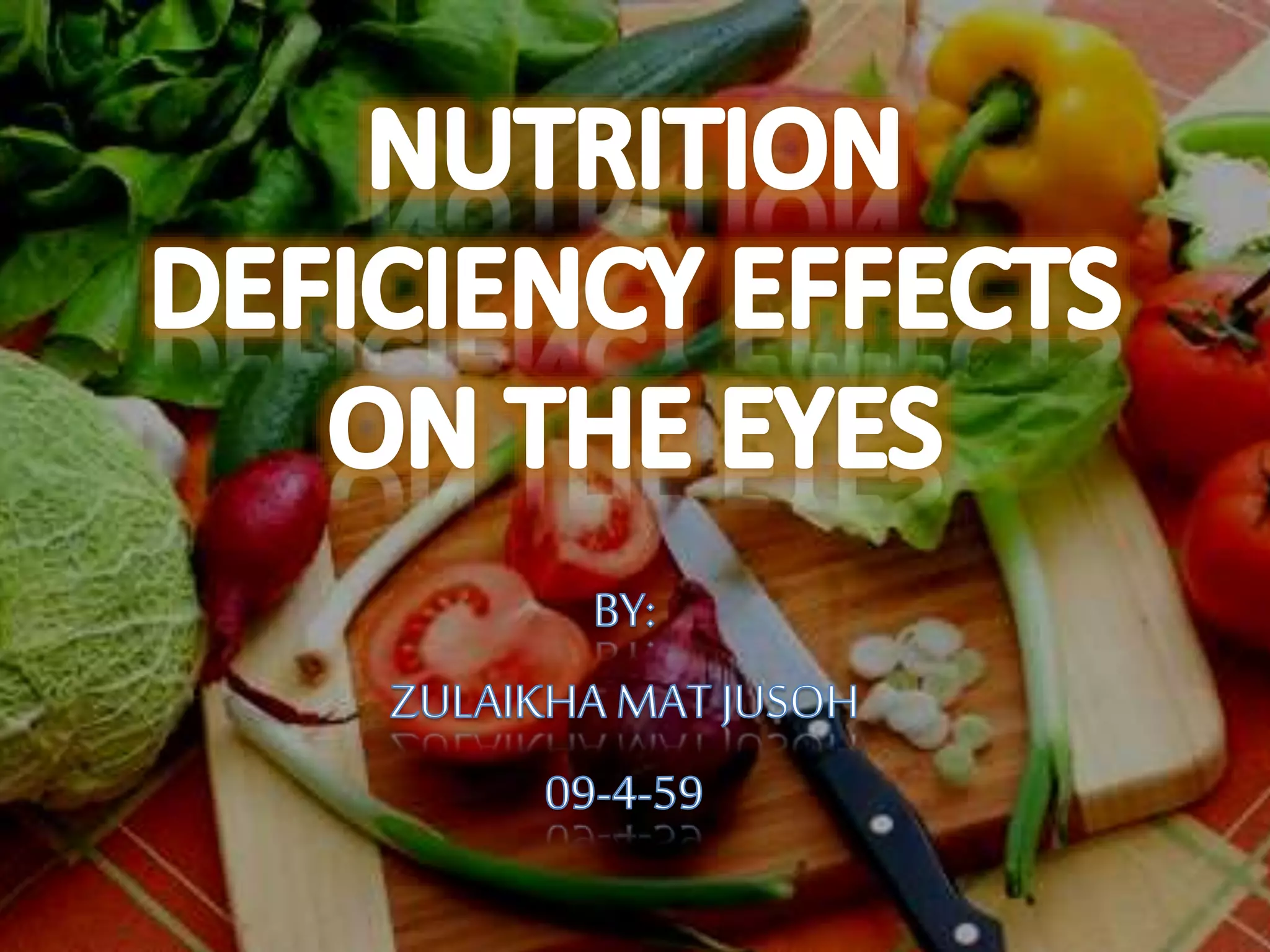 Nutrition deficiency effects on the eyes | PPTX