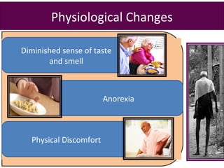 Nutrition during old age | PPT