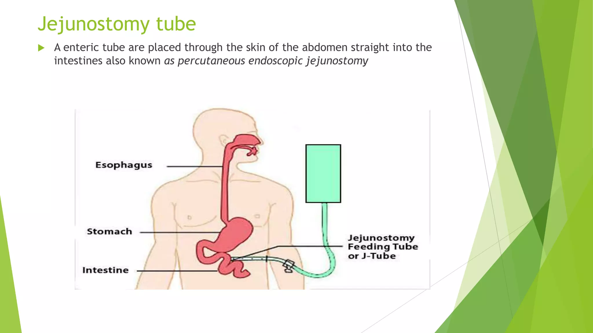NUTRITION FEEDING MODES(parenteral ^0 enteral feeding).pptx