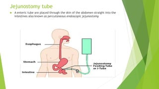 NUTRITION FEEDING MODES(parenteral ^0 enteral feeding).pptx