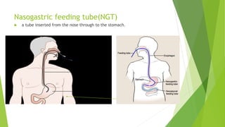 NUTRITION FEEDING MODES(parenteral ^0 enteral feeding).pptx