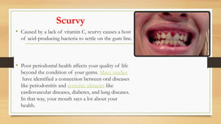Nutrition for oral and dental health.pptx