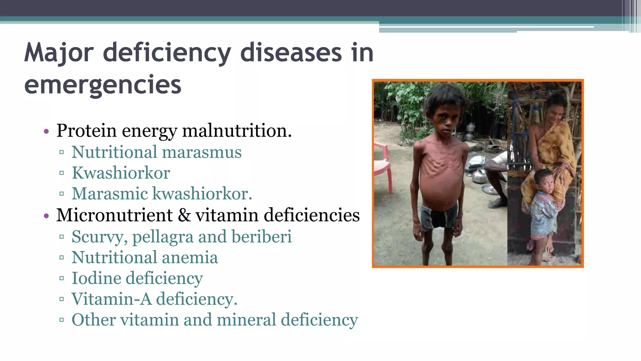 Nutrition in emergencies | PPTX