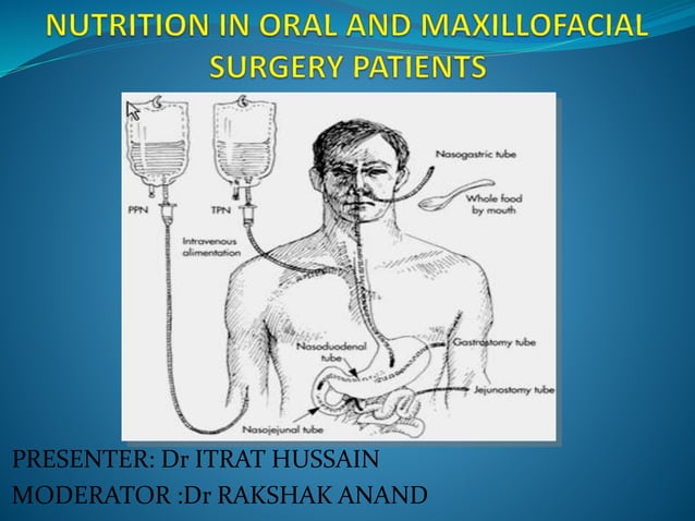 Nutrition in omfs ih | PPTX | Digestive Disorders | Diseases and Conditions