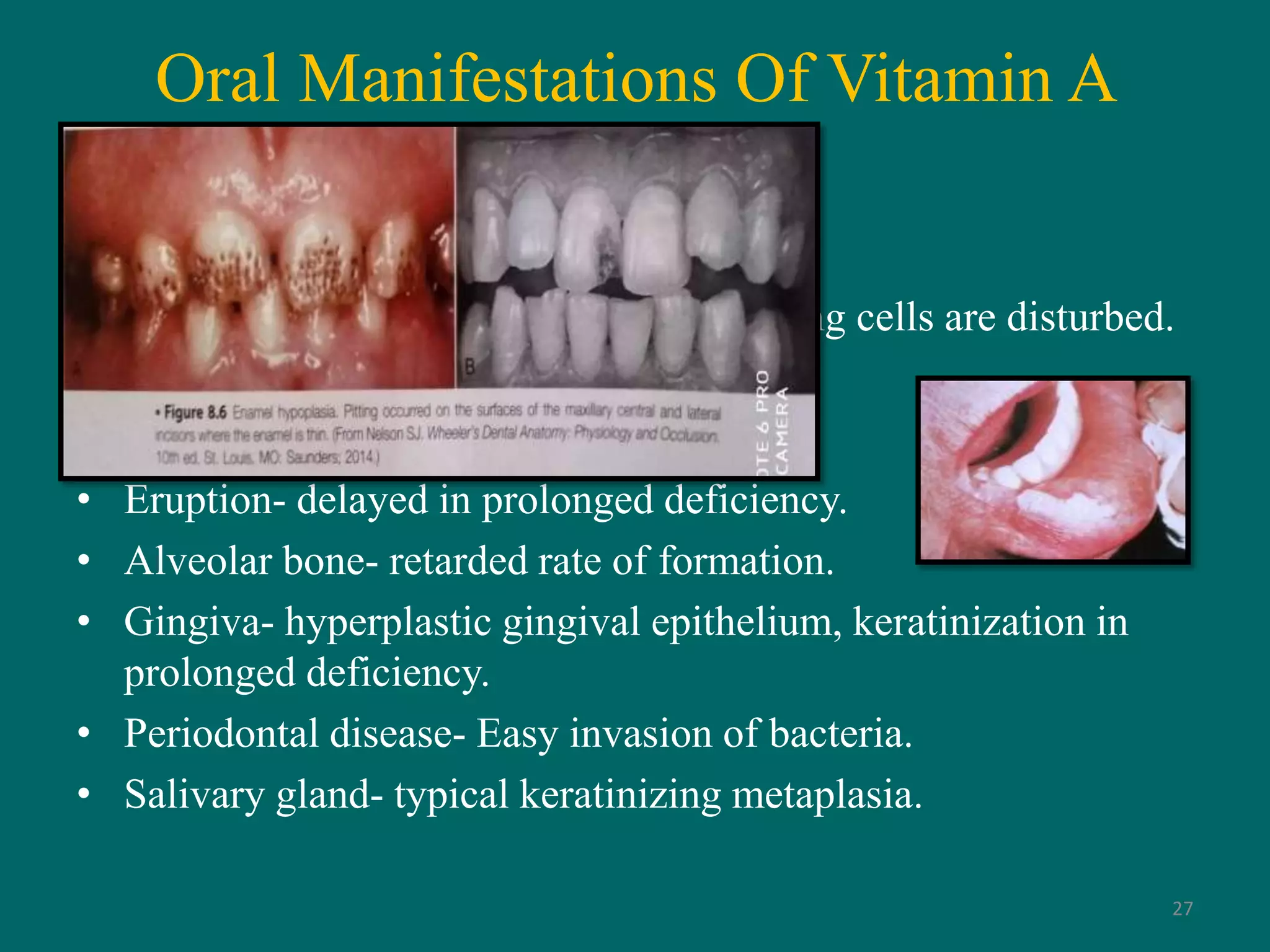 Nutrition in Oral Health of Children | PPTX