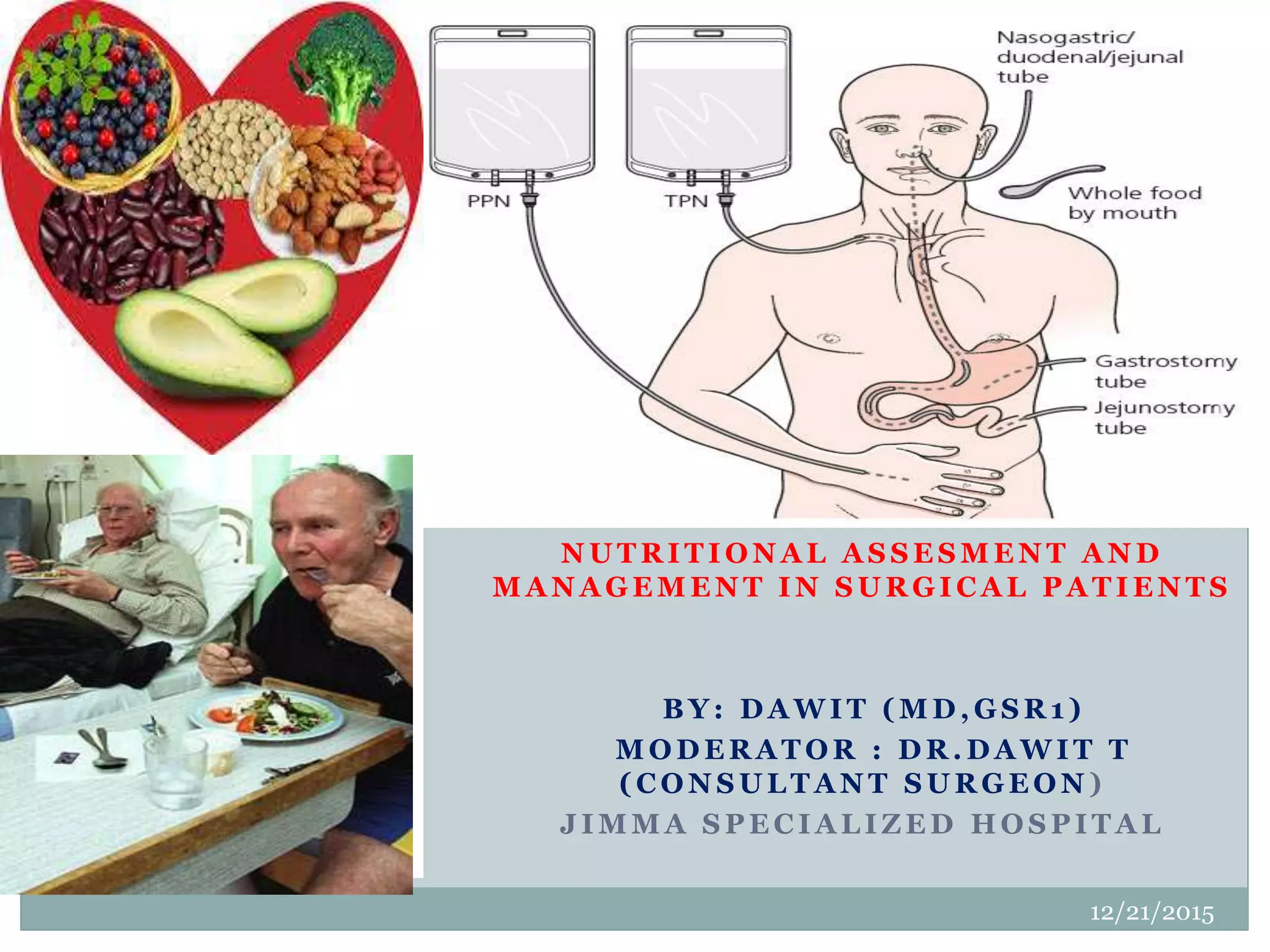 Nutrition in surgery | PPTX