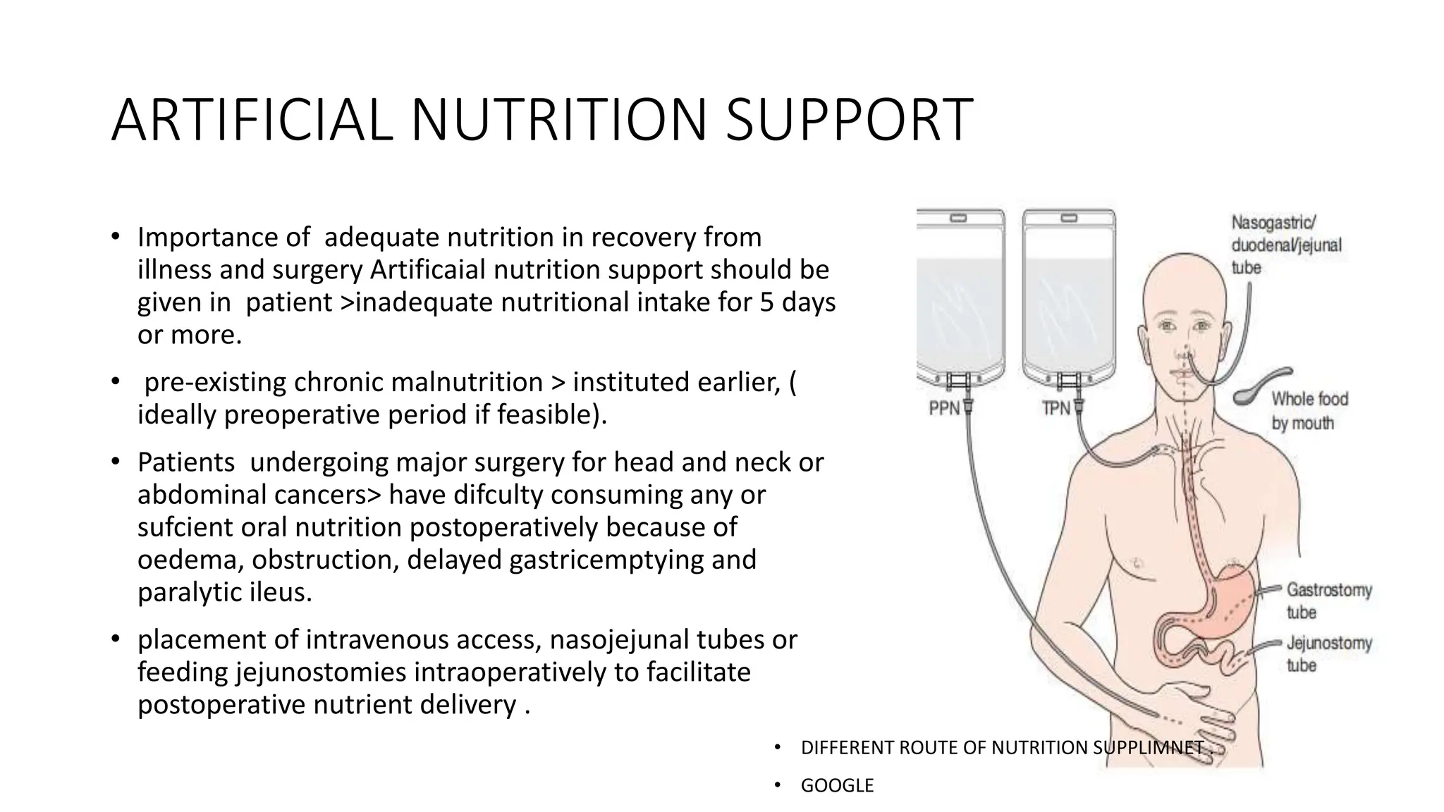 NUTRITION IN SURGERY Nutrition in both pre ops and post is a key ...