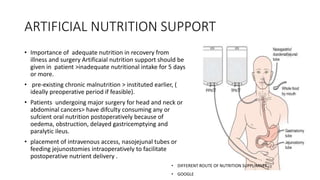 NUTRITION IN SURGERY Nutrition in both pre ops and post is a key ...