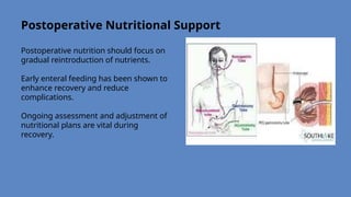 Nutrition_Of_Surgical_Patient_Therapeutic_Nutrition_by_Rajesh.pptx