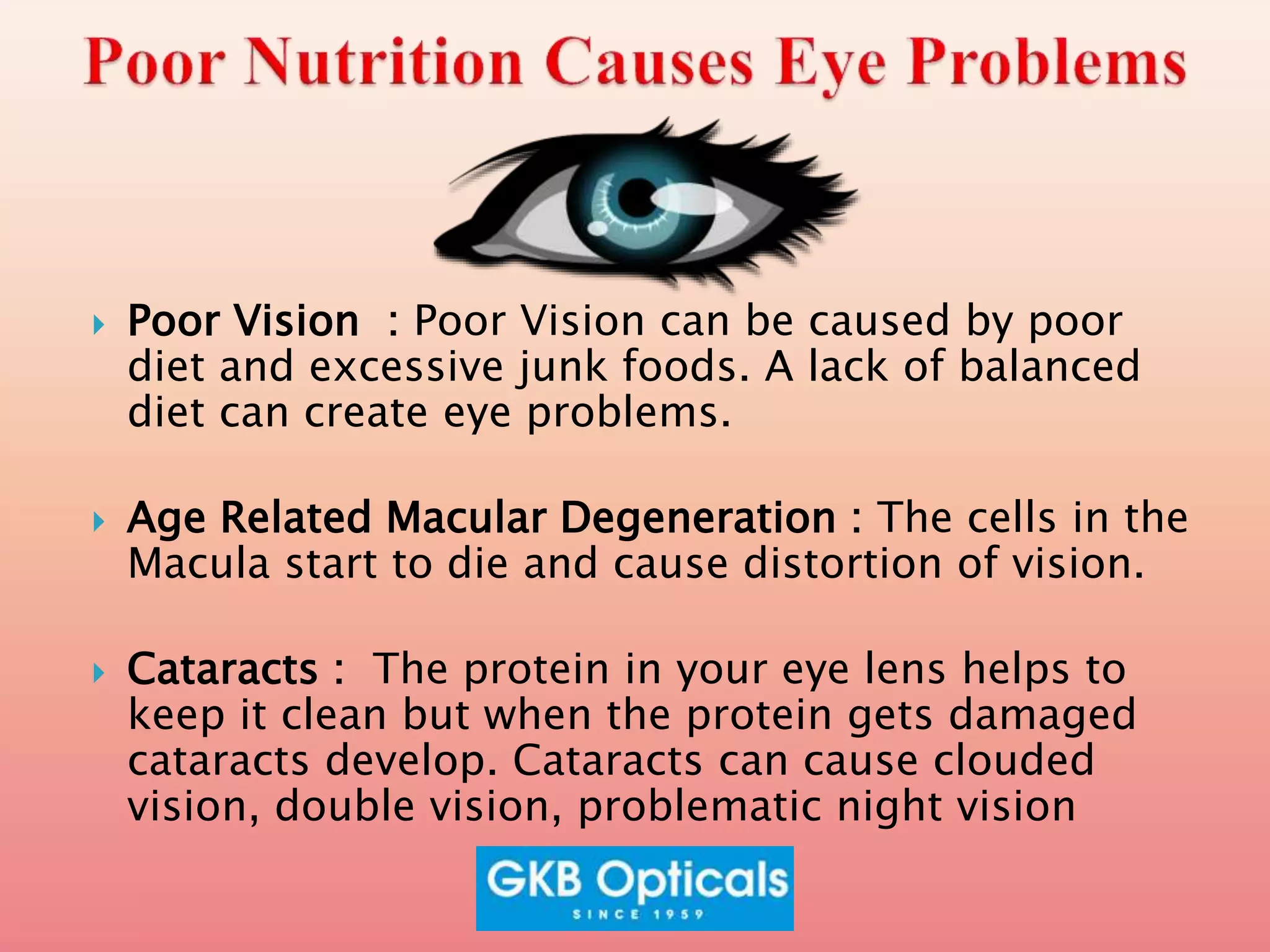 Nutritious food for Healthy Eye | PPTX