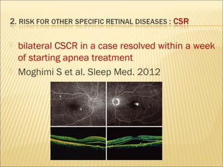 Nw2013 rcopt retinopathies in sleep apnea09 | PPT