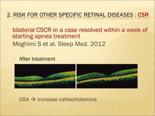 Nw2013 rcopt retinopathies in sleep apnea09 | PPT