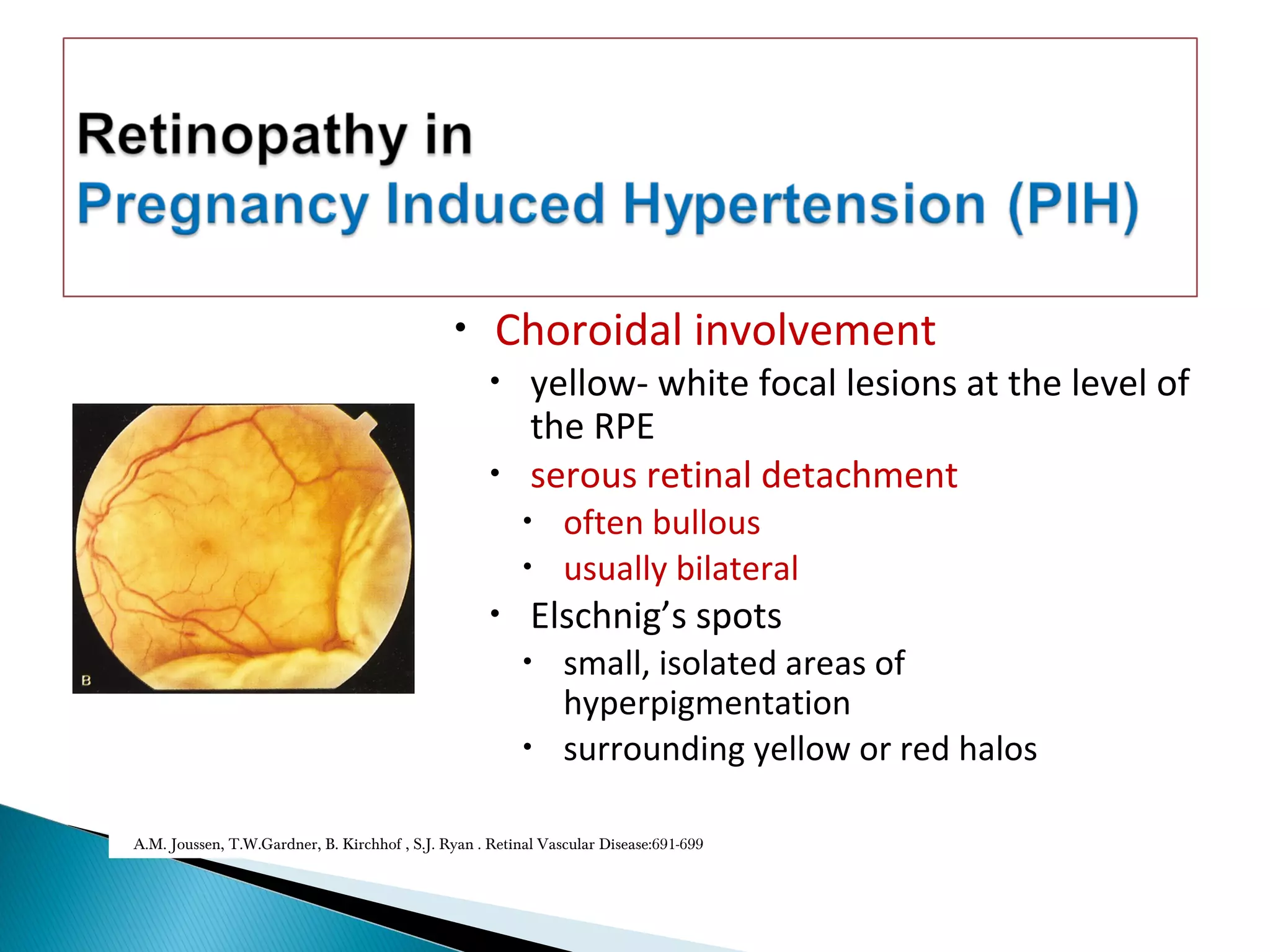 Nw2013 retinopathies inpregnancyfinal | PPT