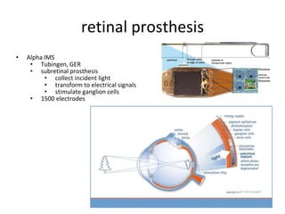 Nw2016 retinitis pigmentosa | PPT