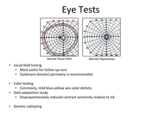 Nw2016 retinitis pigmentosa | PPT