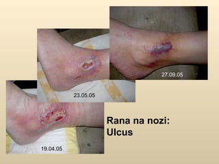 Nwa blue nature aloe vera | PPT