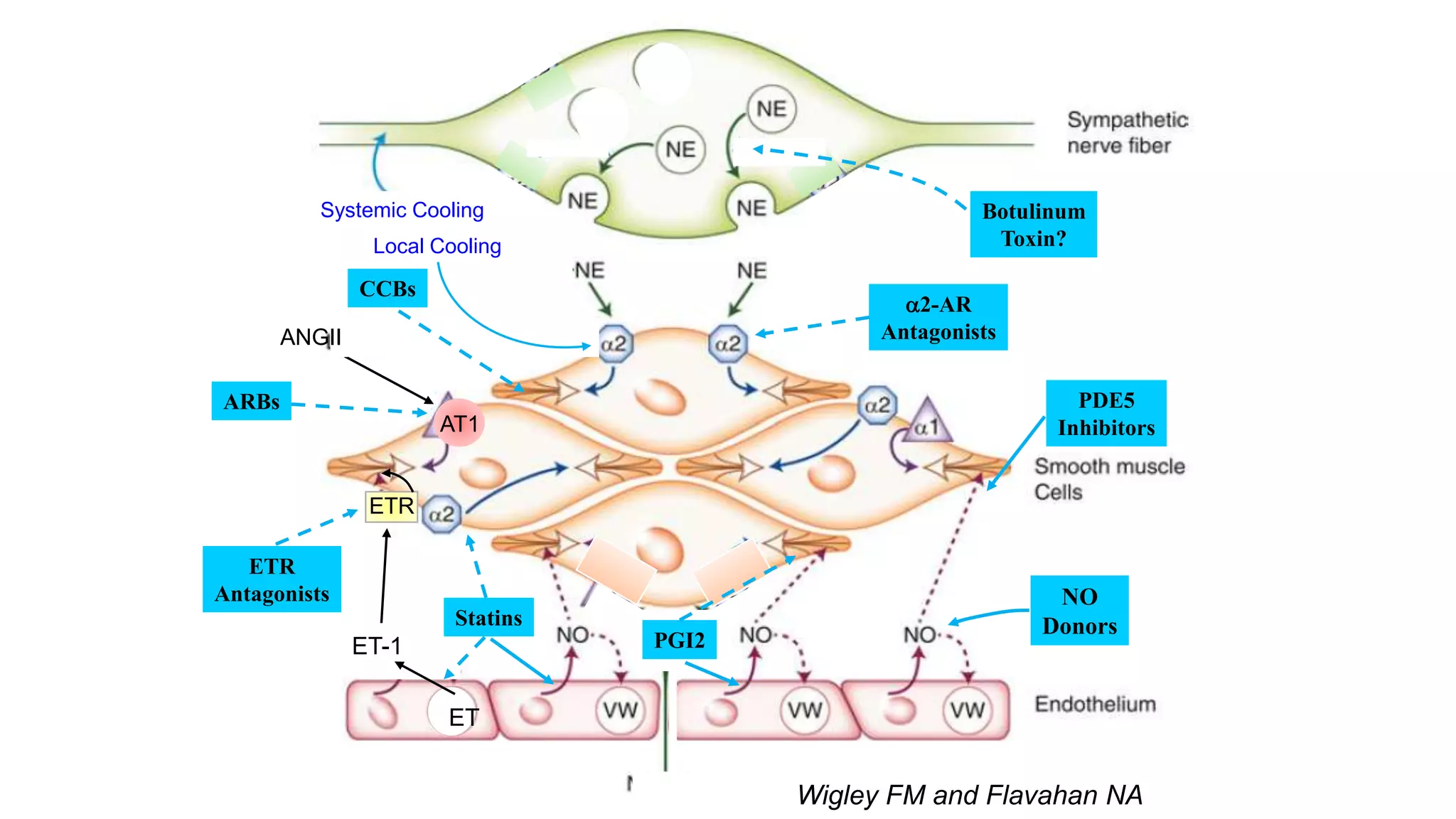 Raynaud Phenomenon and Digital Ulcers in Scleroderma | PPTX
