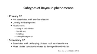 Raynaud Phenomenon and Digital Ulcers in Scleroderma | PPTX