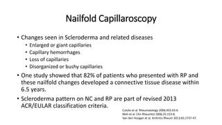 Raynaud Phenomenon and Digital Ulcers in Scleroderma | PPTX