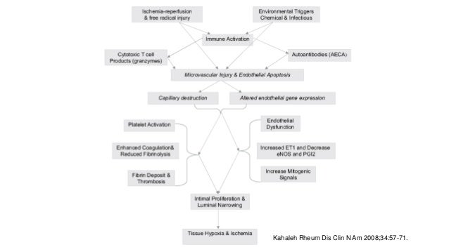 Raynaud Phenomenon And Digital Ulcers In Scleroderma