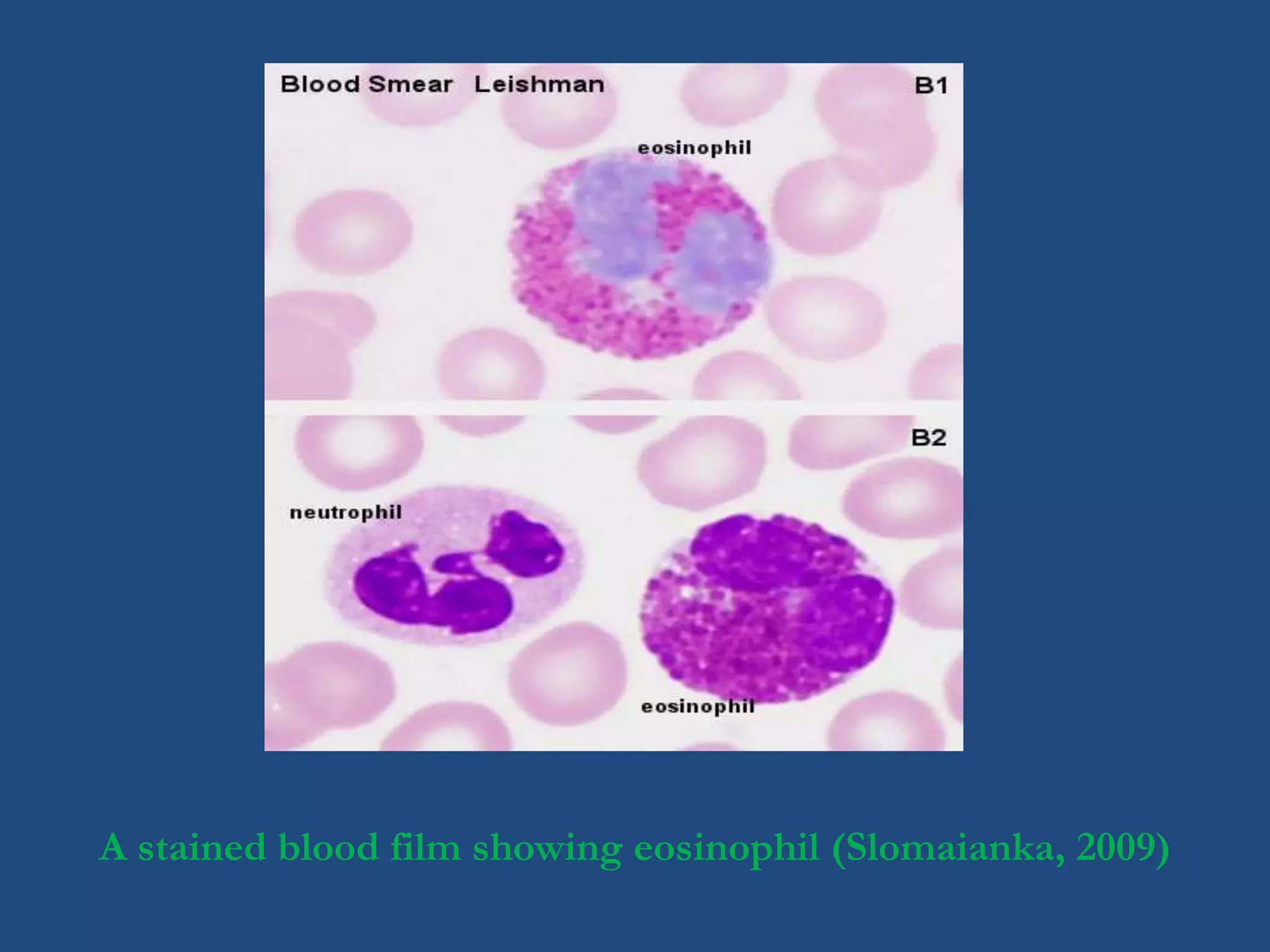 BLOOD FILM EXAMINATION: ITS RECENT INVESTIGATIVE METHODOLOGY IN THE ...
