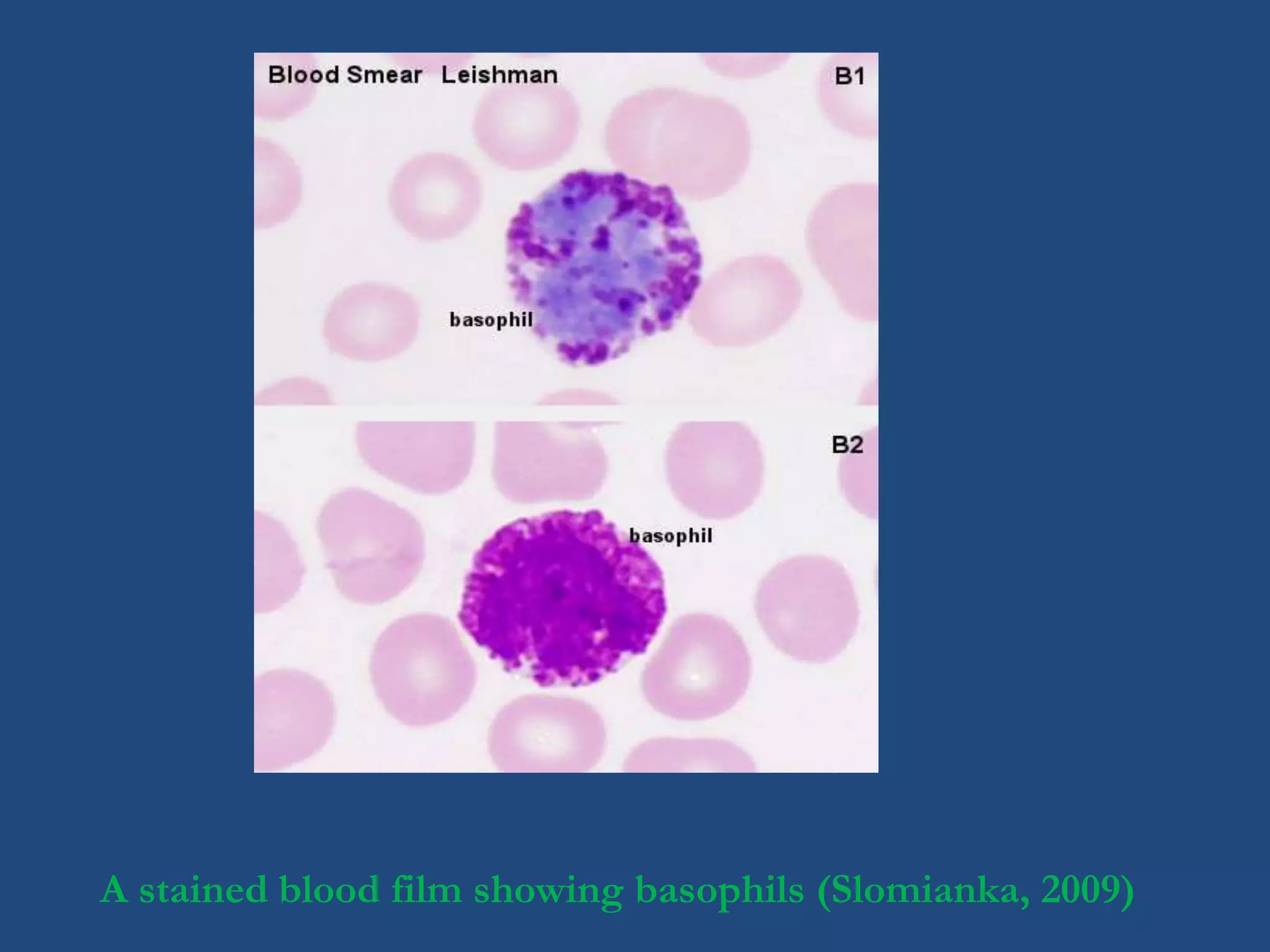 BLOOD FILM EXAMINATION: ITS RECENT INVESTIGATIVE METHODOLOGY IN THE ...