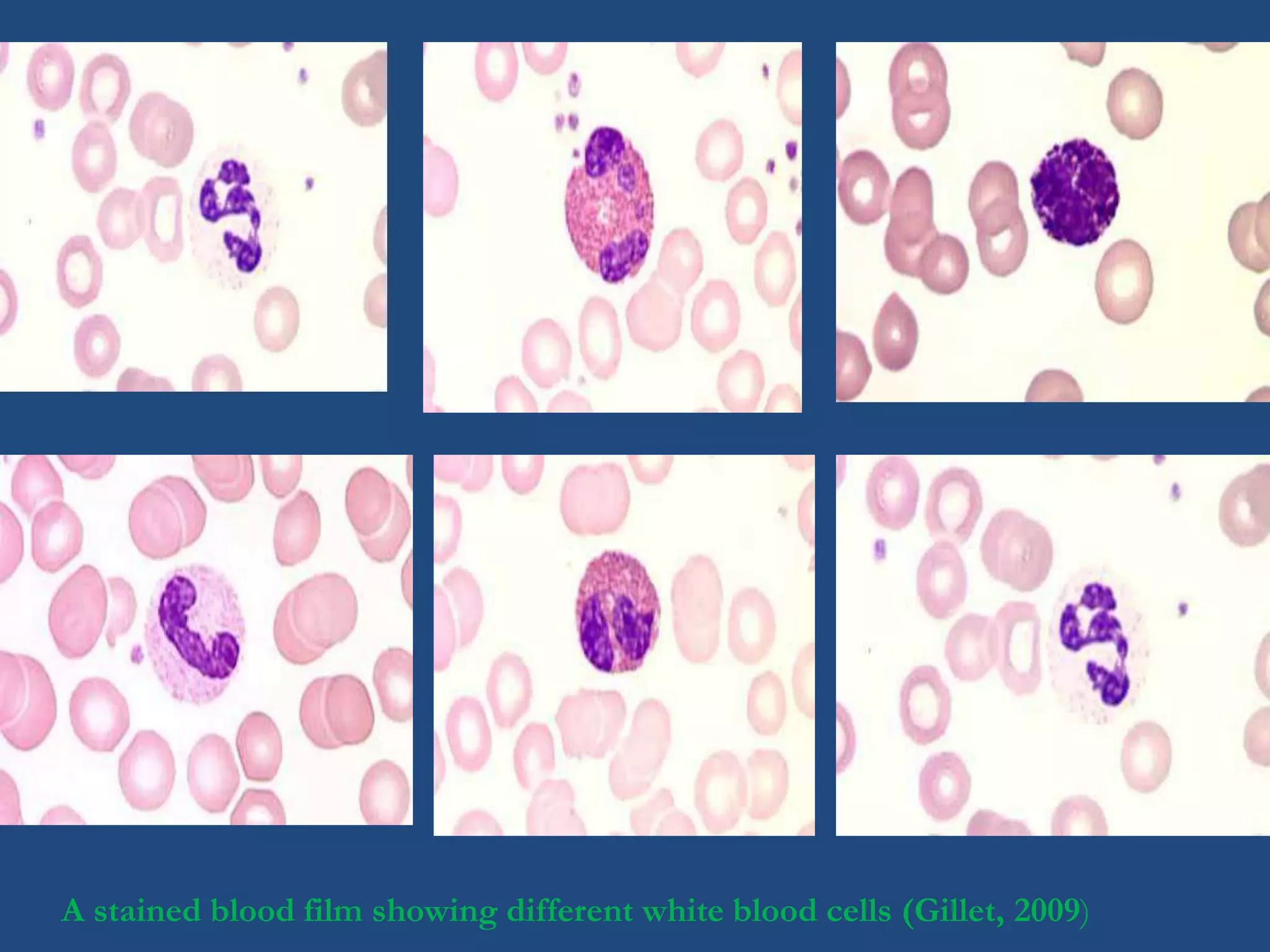 BLOOD FILM EXAMINATION: ITS RECENT INVESTIGATIVE METHODOLOGY IN THE ...