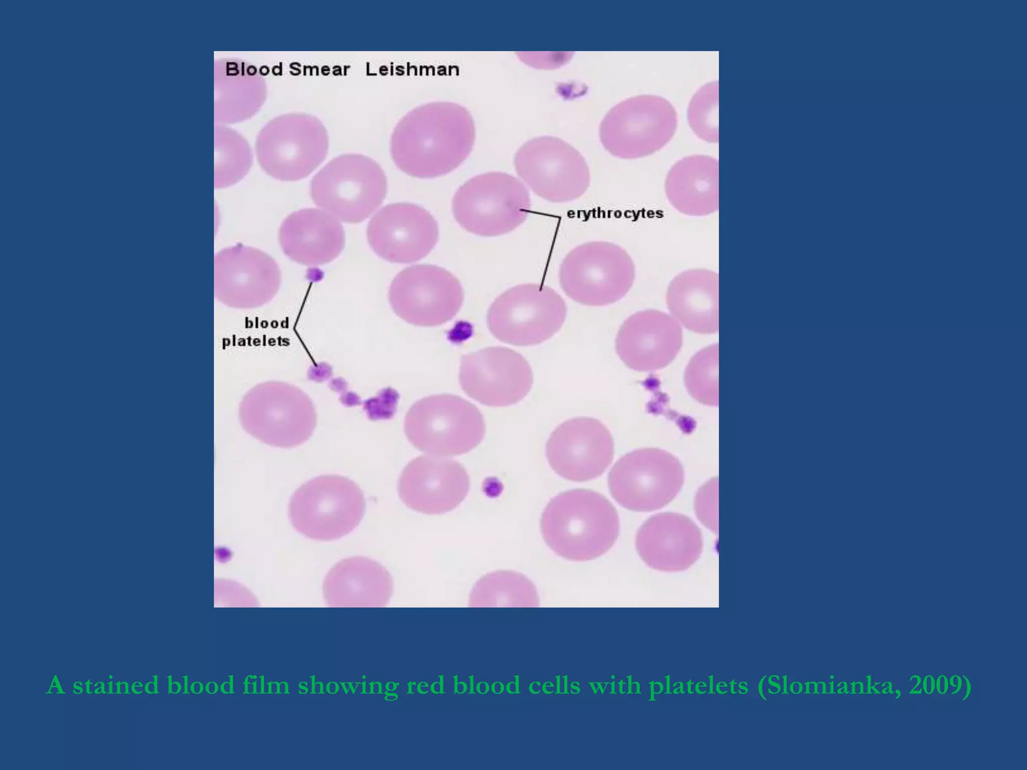 BLOOD FILM EXAMINATION: ITS RECENT INVESTIGATIVE METHODOLOGY IN THE ...