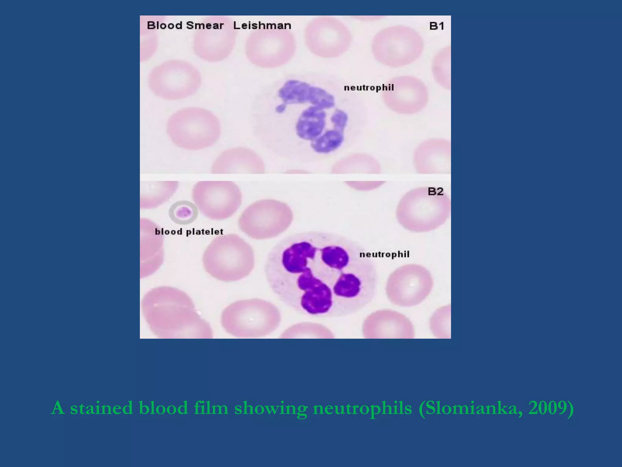 BLOOD FILM EXAMINATION: ITS RECENT INVESTIGATIVE METHODOLOGY IN THE ...