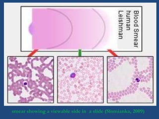 BLOOD FILM EXAMINATION: ITS RECENT INVESTIGATIVE METHODOLOGY IN THE ...
