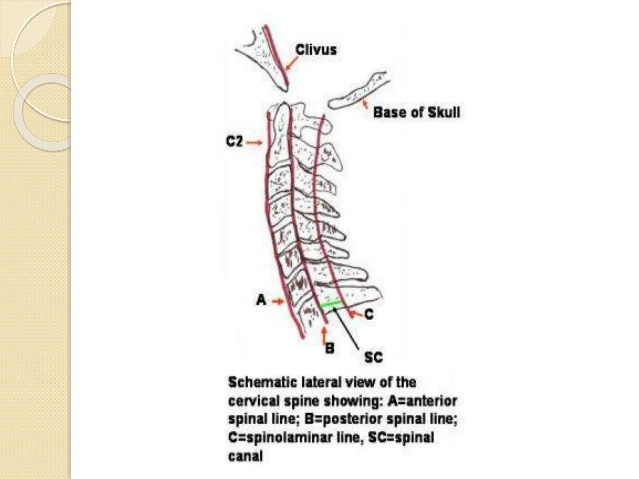 Cervical_Spine.pptx