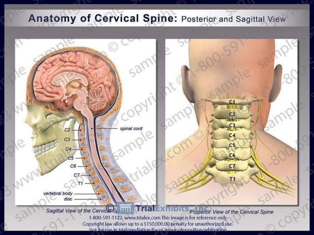 Cervical_Spine.pptx