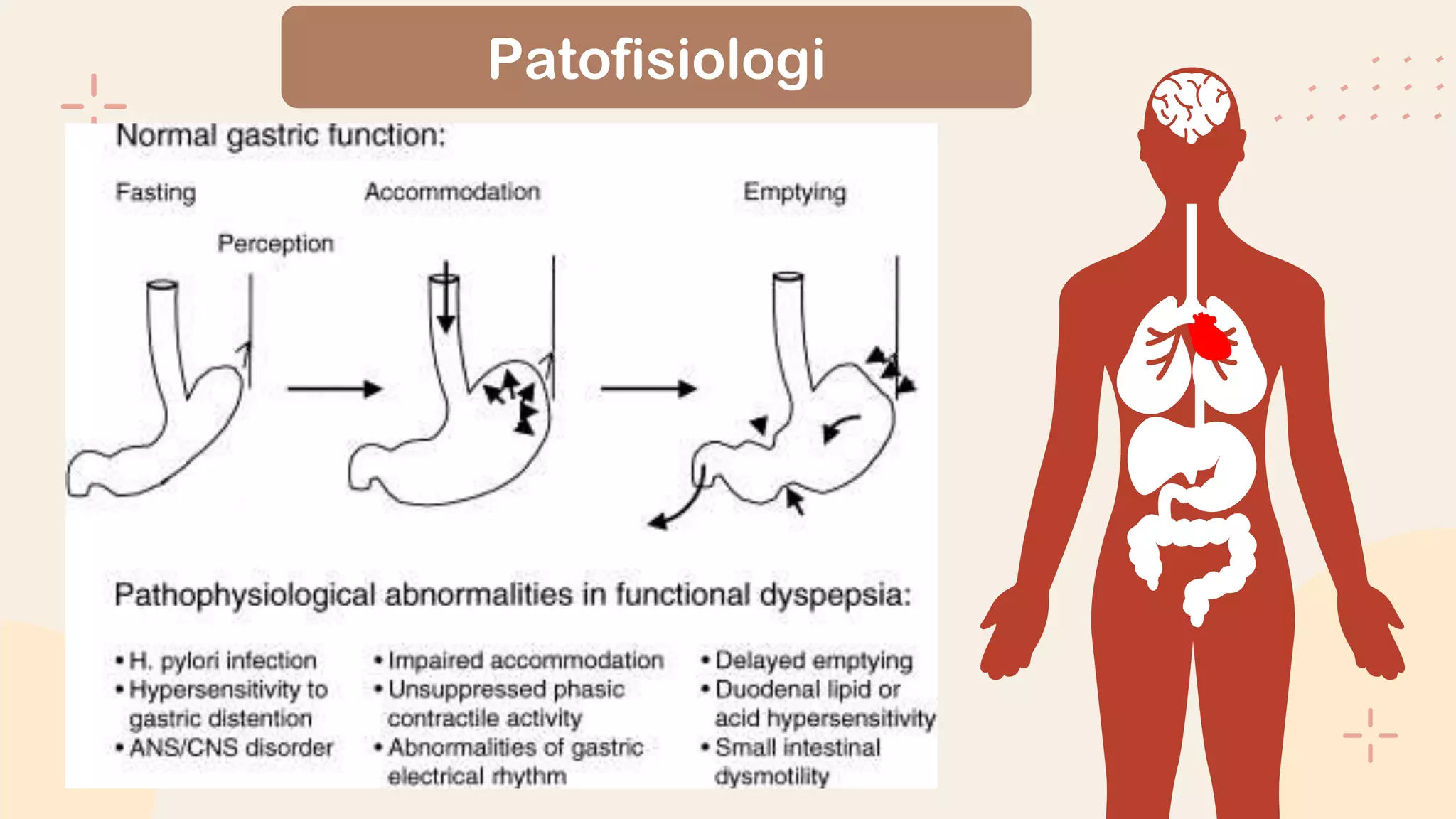 Nyeri Epigastrium.pptx
