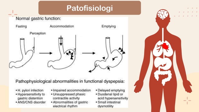 Nyeri Epigastrium.pptx