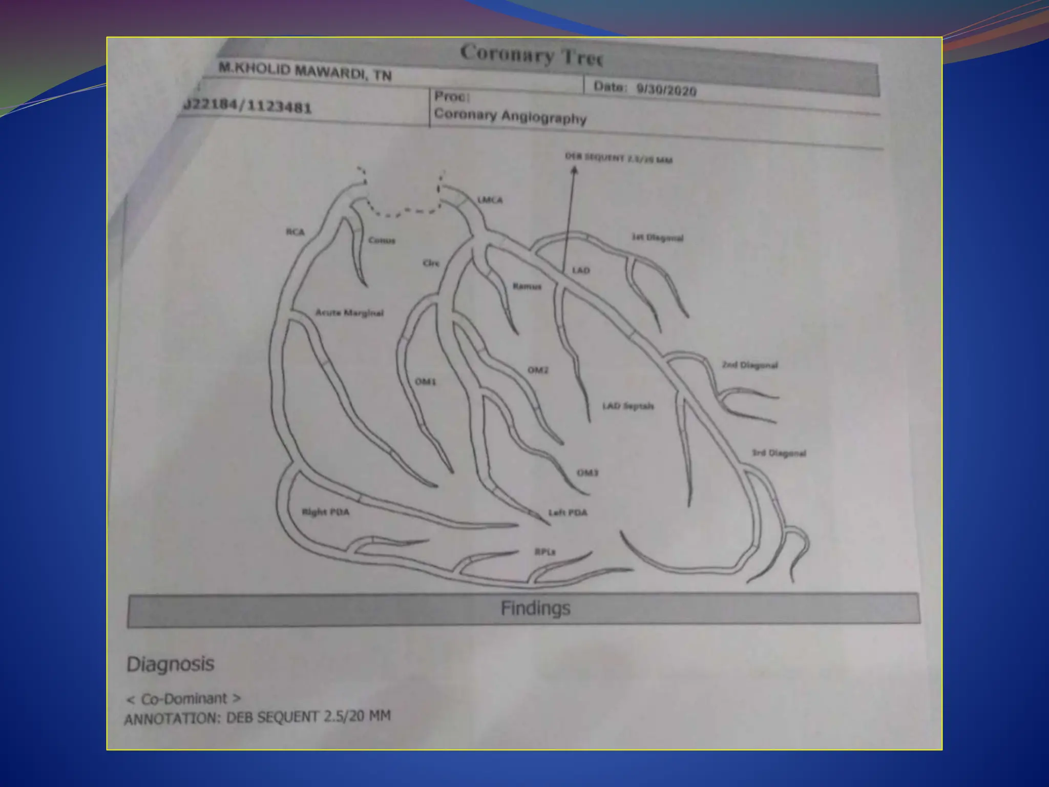Ny erniyati Total AV Block case report.pptx